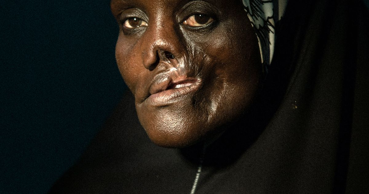 Faces of Noma - PhMuseum