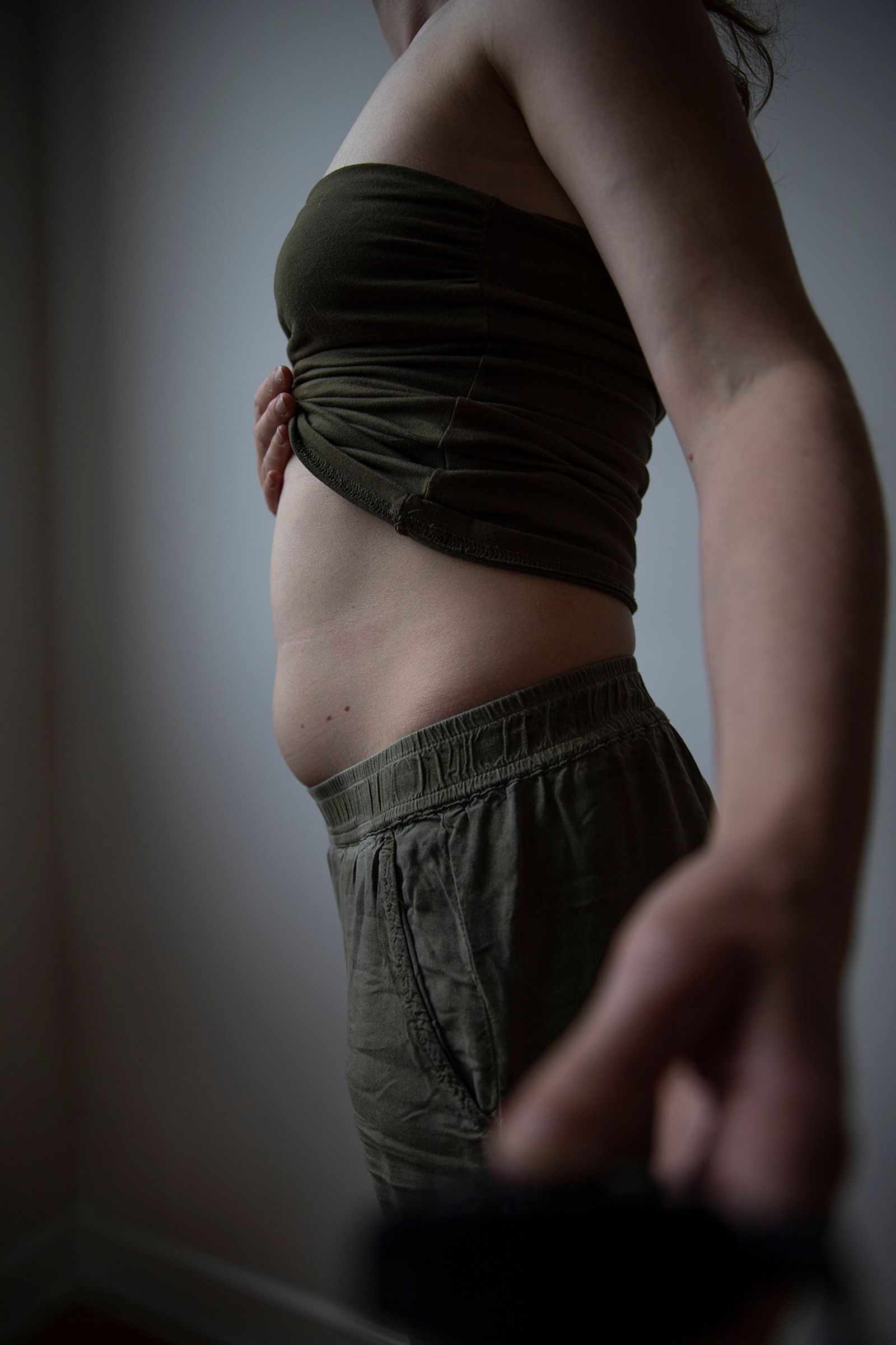 Burning Lilies - PhMuseum