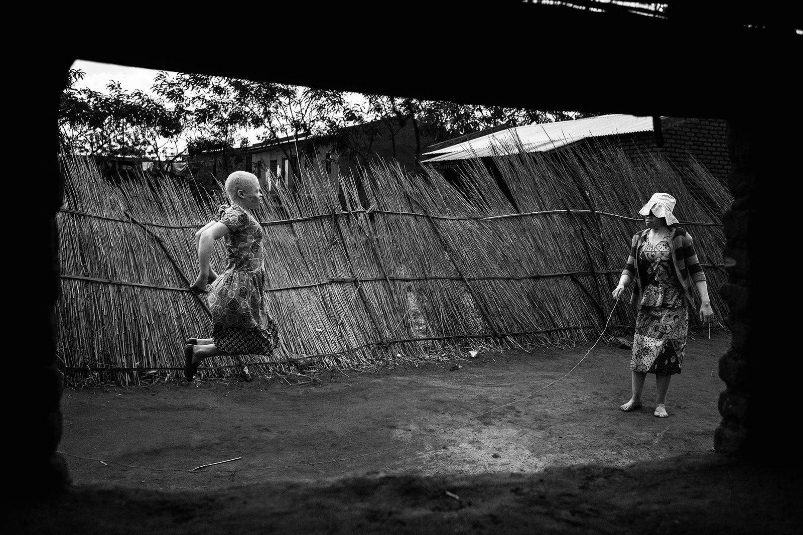 The hunted - albinos - PhMuseum