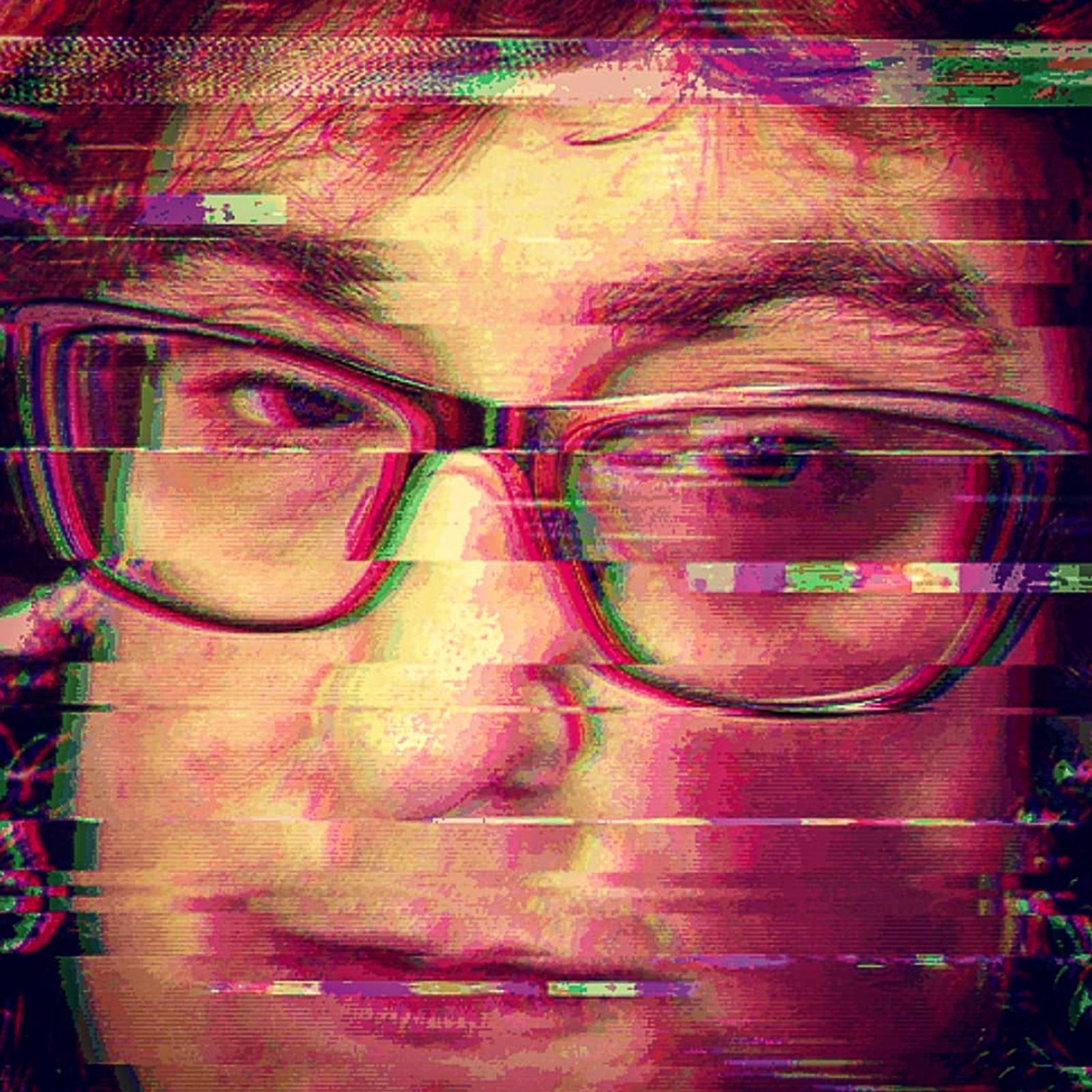 Addison's Disease - Behind the Smile - PhMuseum