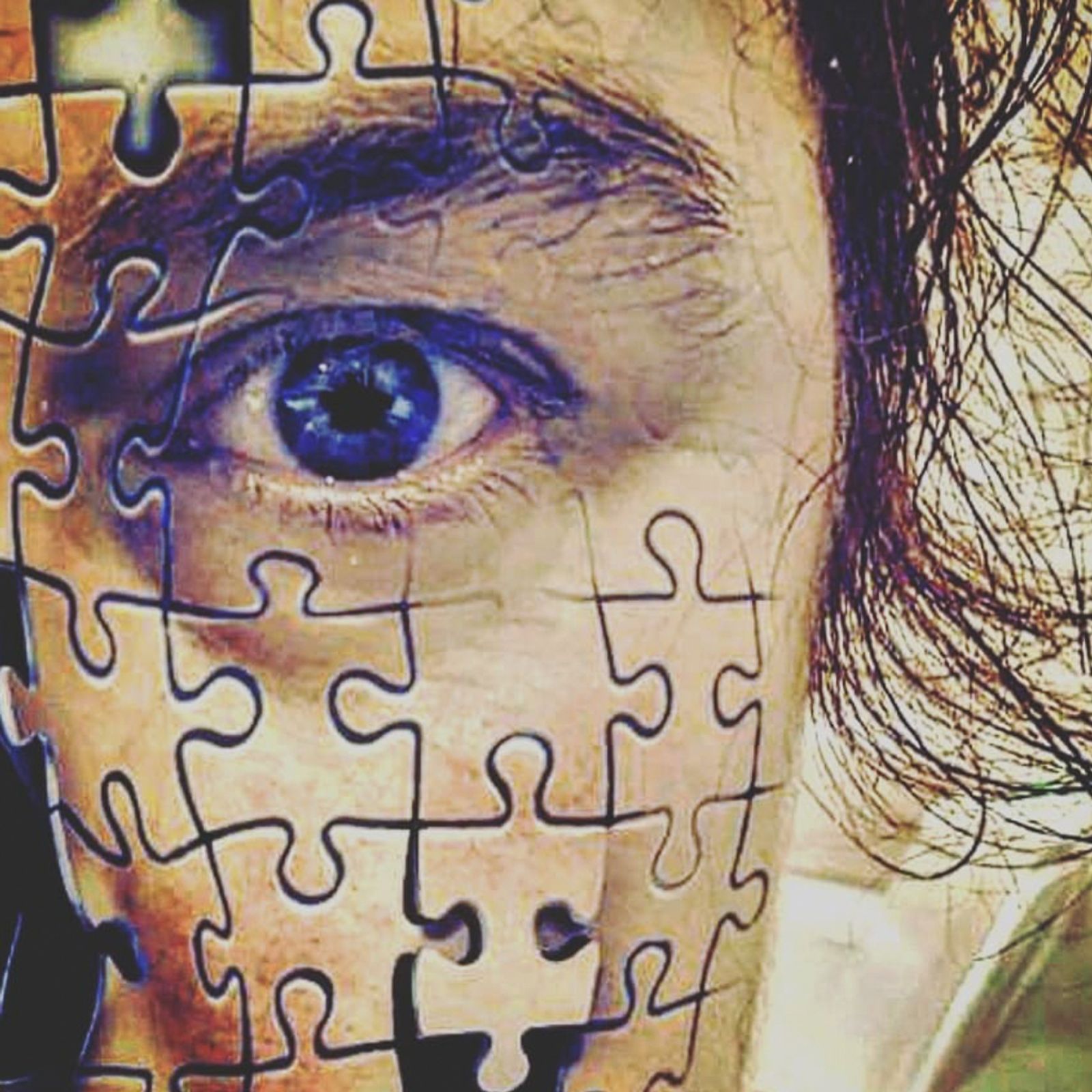 Addison's Disease - Behind the Smile - PhMuseum