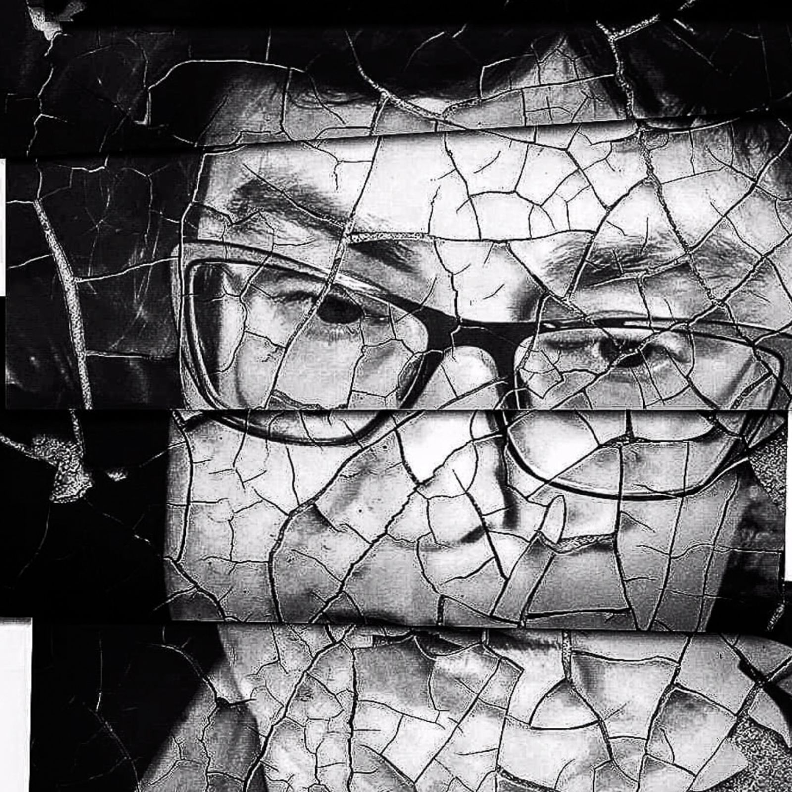 Addison's Disease - Behind the Smile - PhMuseum