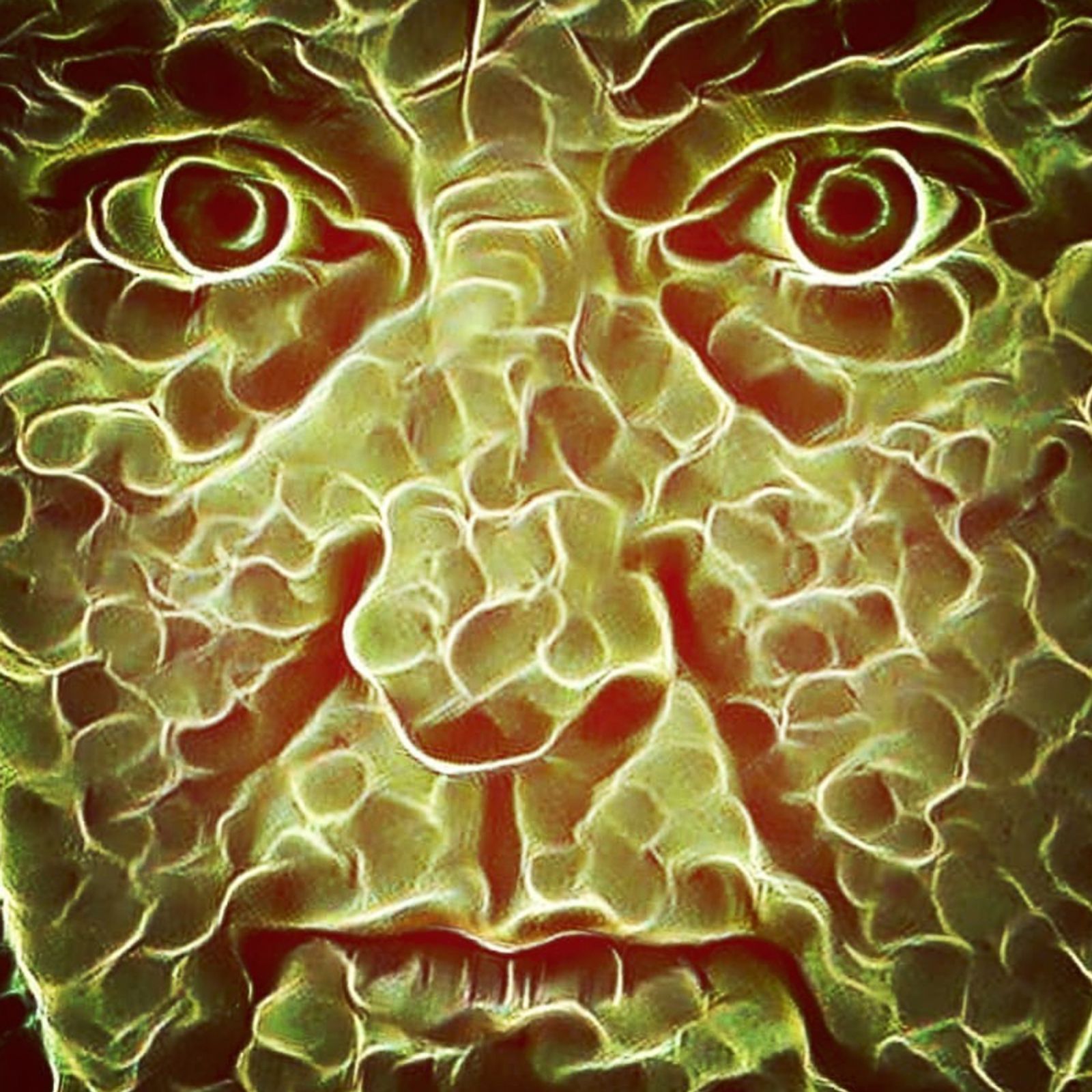 Addison's Disease - Behind the Smile - PhMuseum