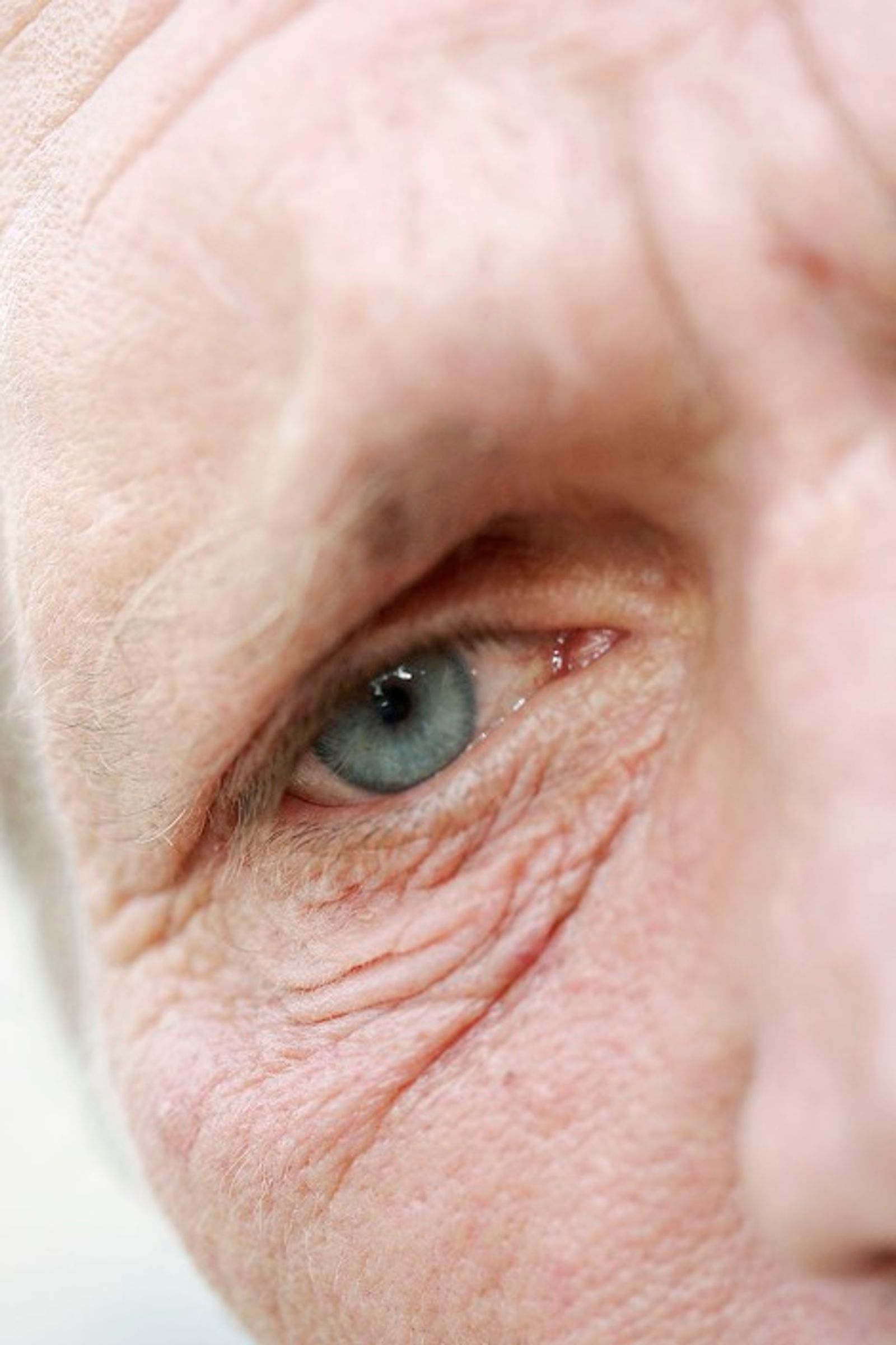 After Chernobyl - PhMuseum